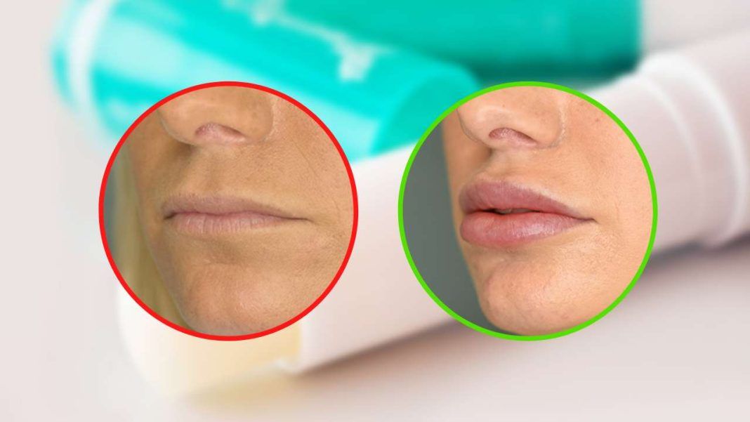 Labbra carnosissime, dimentica il filler: questa maschera rimpolpante ...